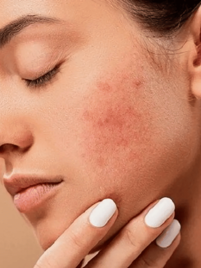 Top 5 Skin Benefits of Using Glycerin - Sportskeeda Stories