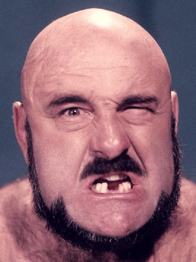 WWE Stars Left Toothless After Matches - Sportskeeda Stories